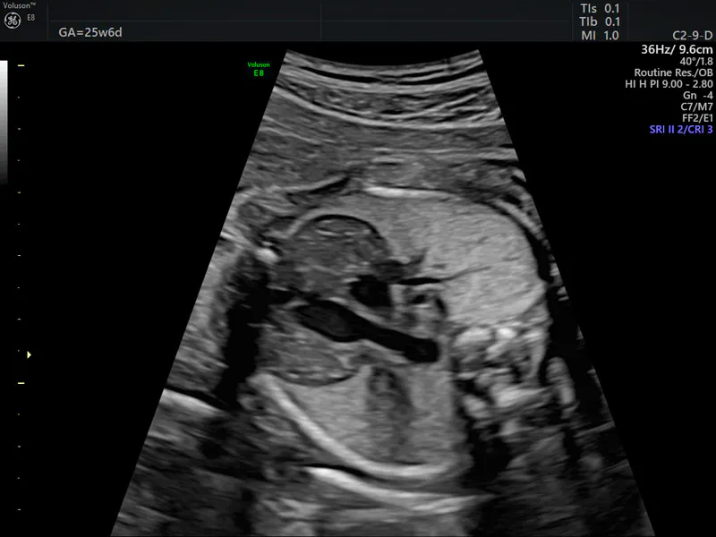 Fetal Cardiac Anomaly Scan | Empowered Women's Health