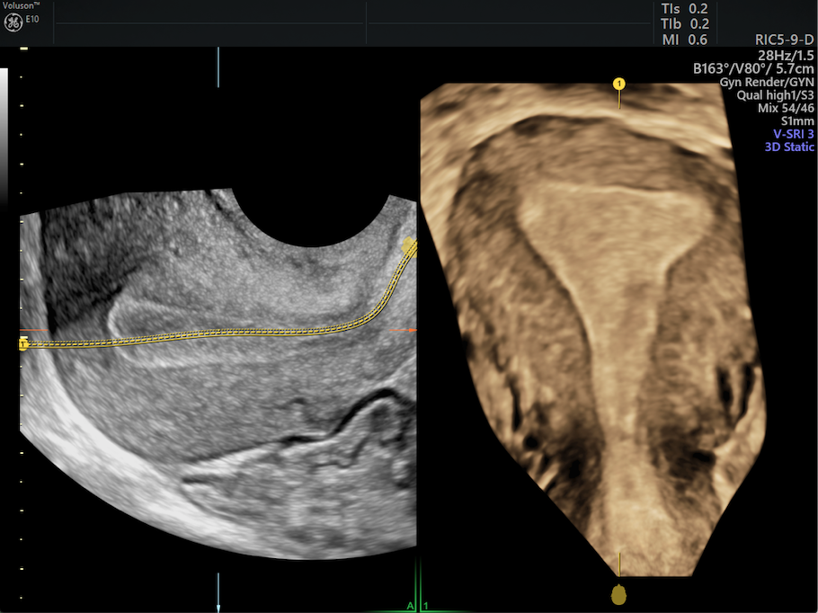 How to Explain the Female Infertility Workup to Patients | Empowered ...