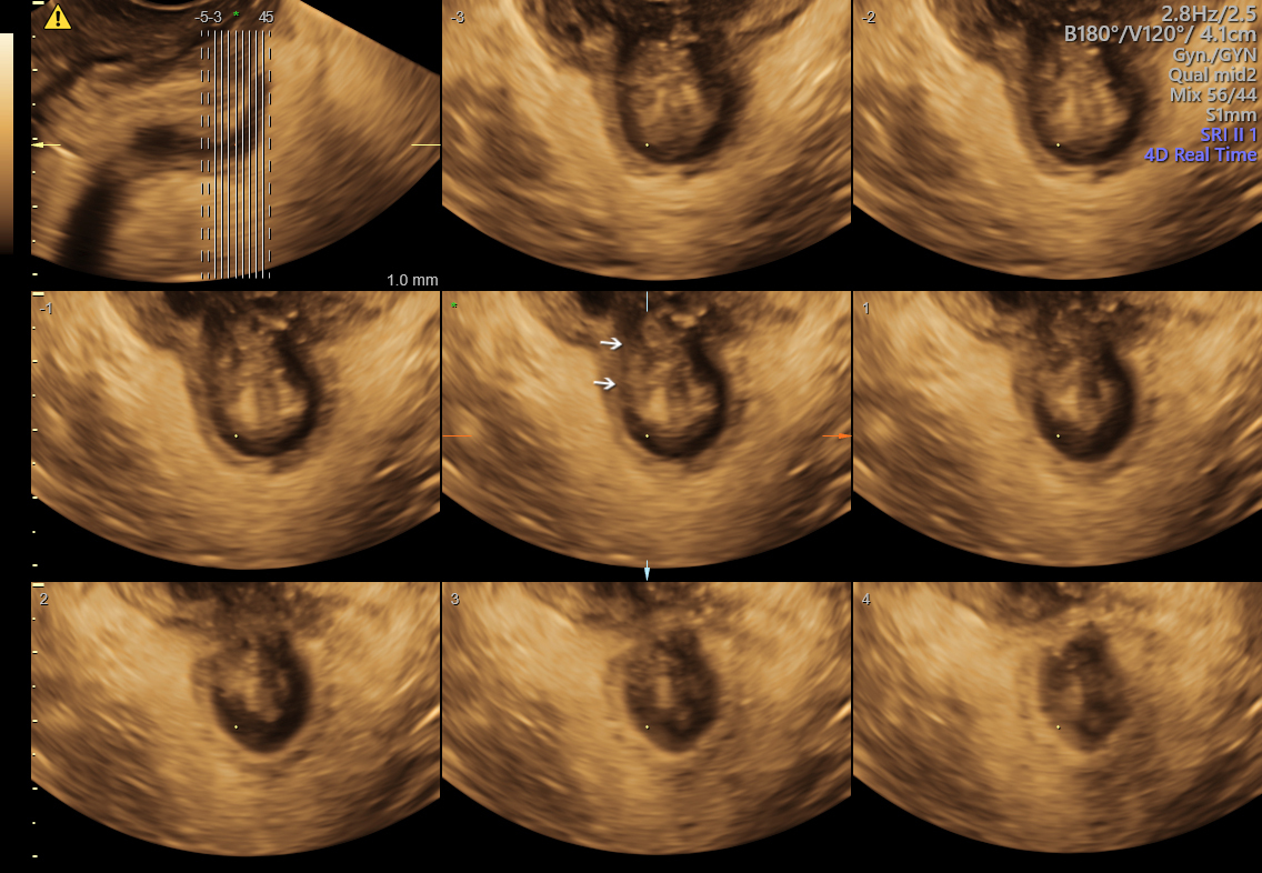 Pelvic Floor Resources to Add To Your Practice | Empowered Women's Health