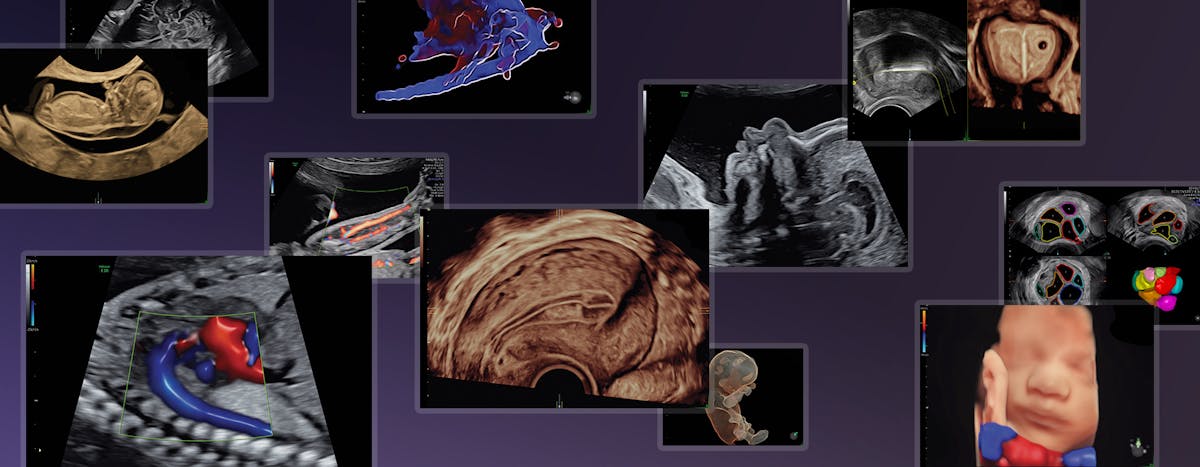 Ultrasound Technology & Innovation | Empowered Women's Health