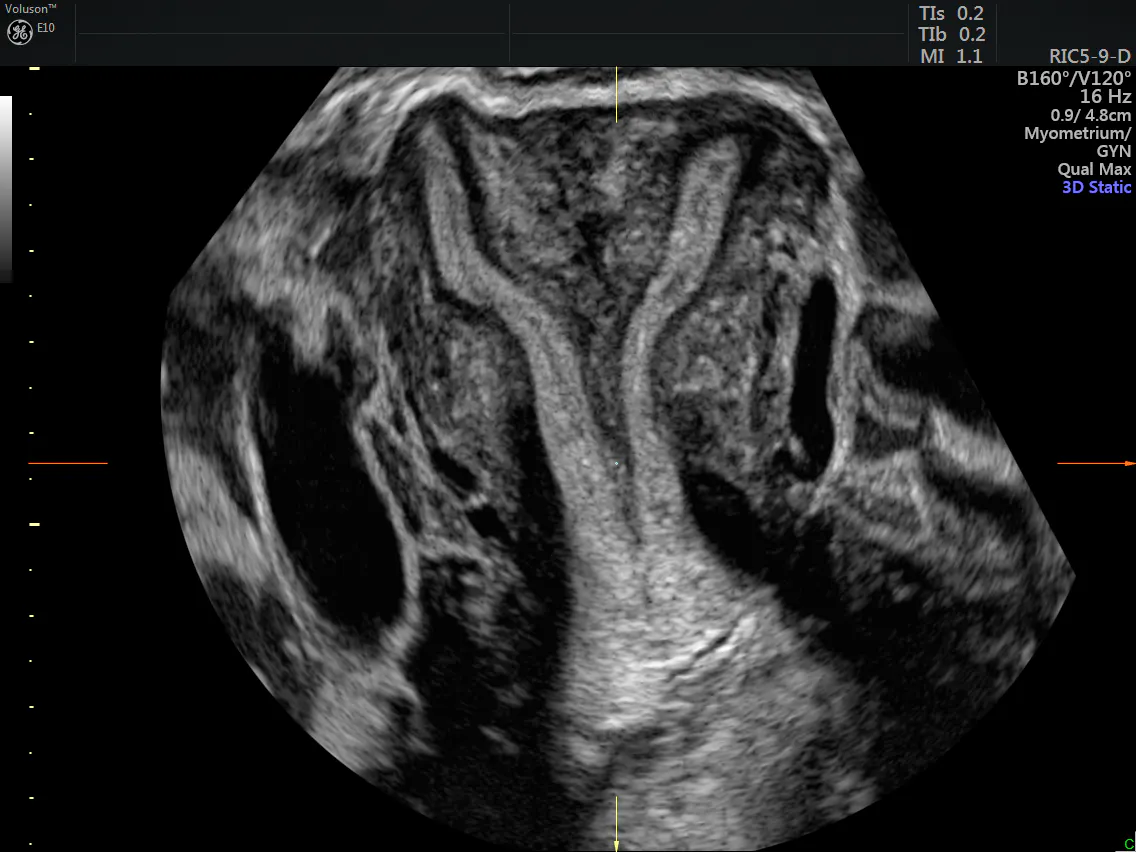Improving Patient Care with 3D Ultrasounds | Empowered Women's Health