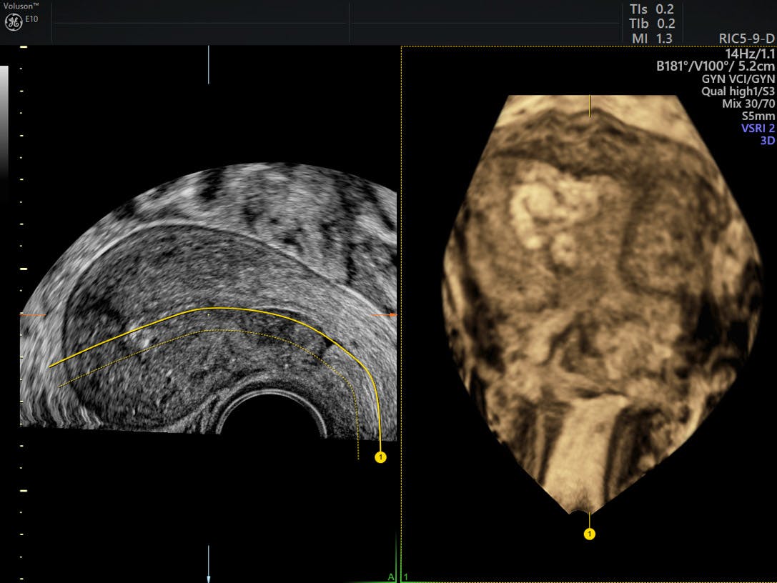 Postpartum Ultrasound | Empowered Women's Health
