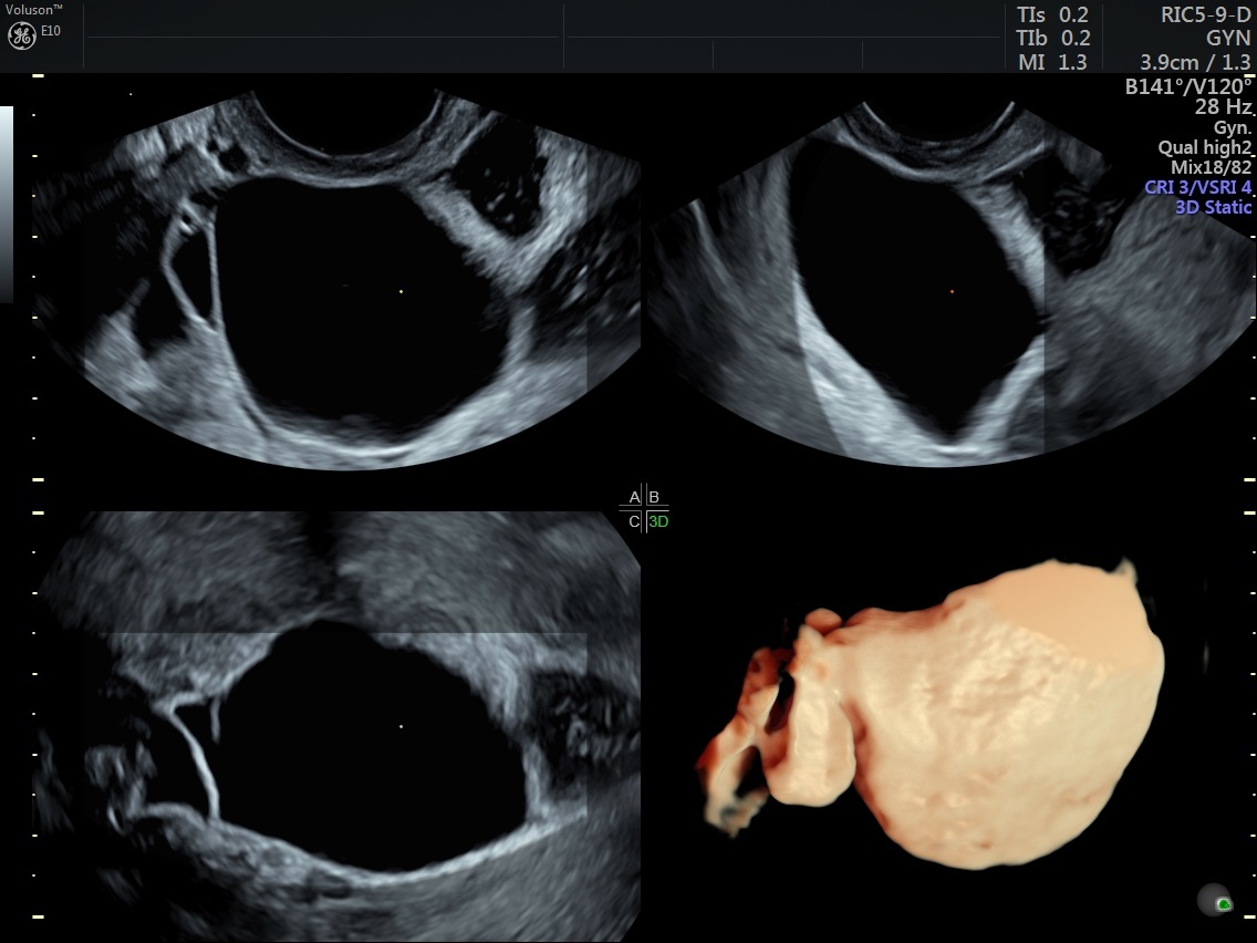 PID Prevention: What Your Patients Need to Know | Empowered Women's Health