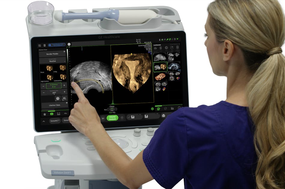 FAQ: Ultrasound Scanning Techniques | Empowered Women's Health