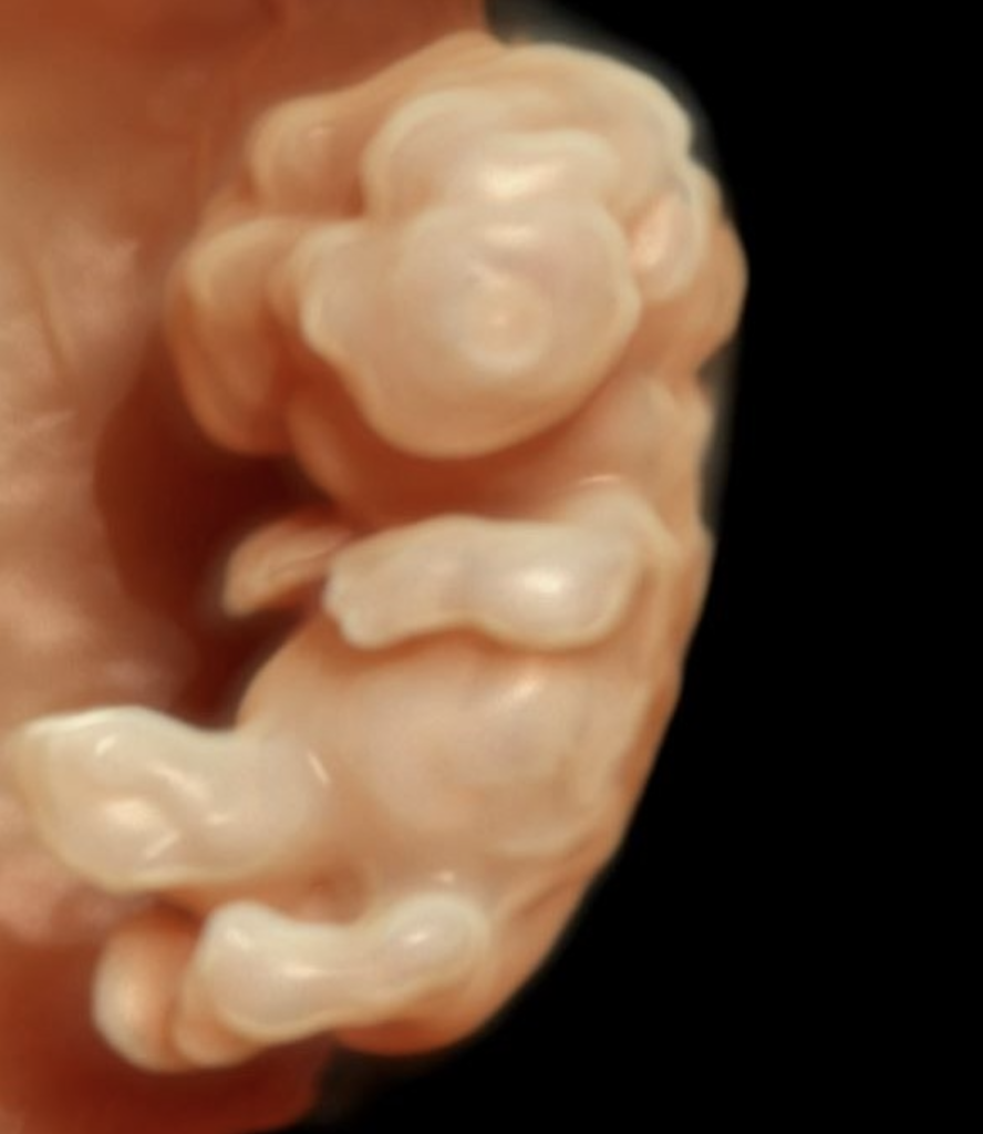 A Guideline-Based Approach to First-Trimester Ultrasound | Empowered ...