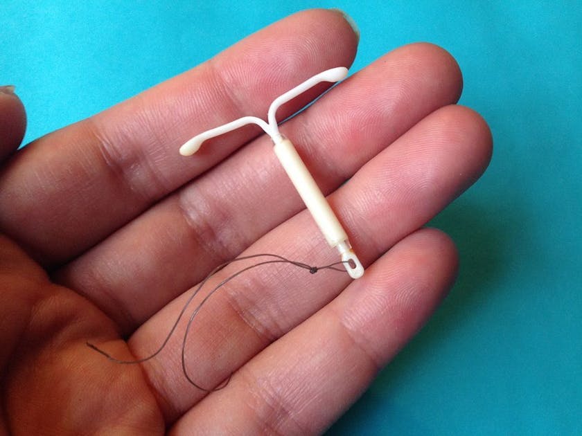 Best Practices for Checking IUD Placement With 3D Ultrasound ...