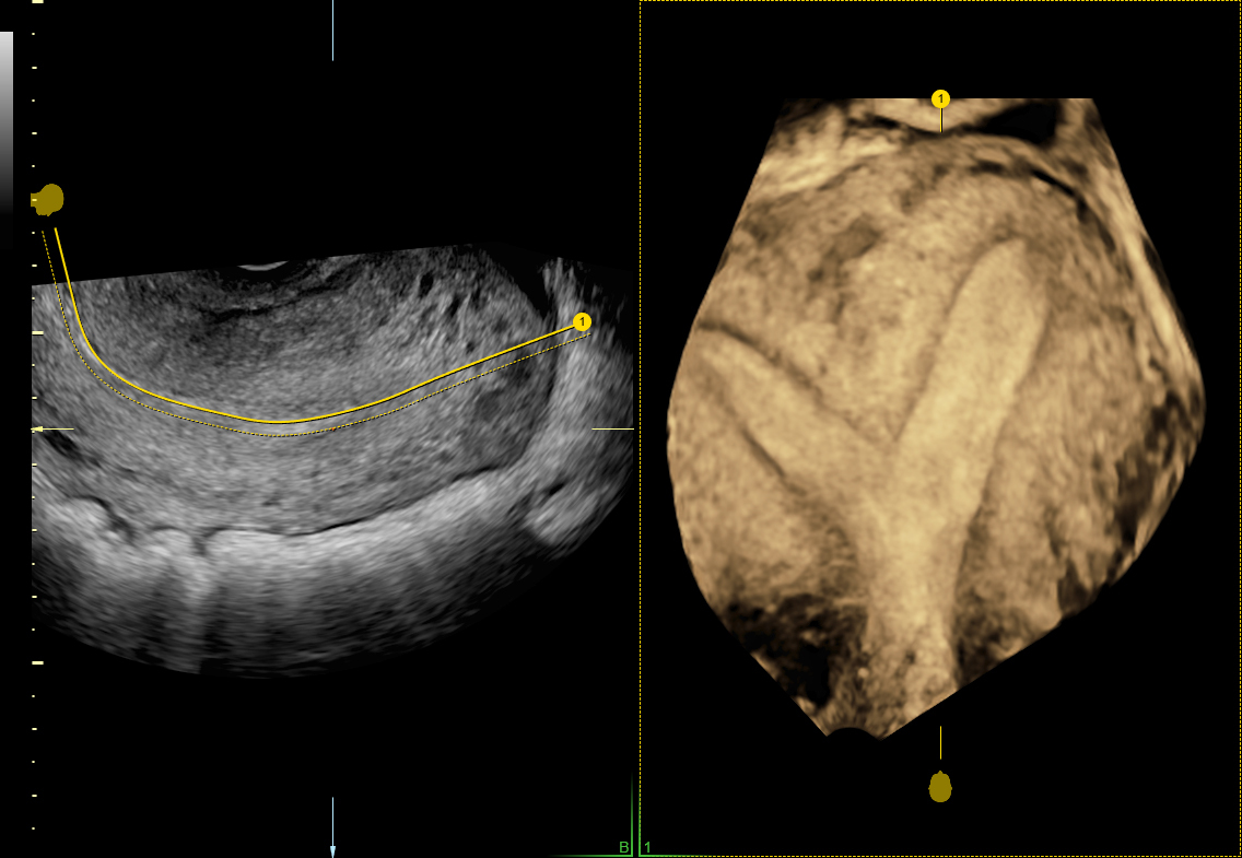 Subfertility & Infertility: Do Patients Know the Difference ...