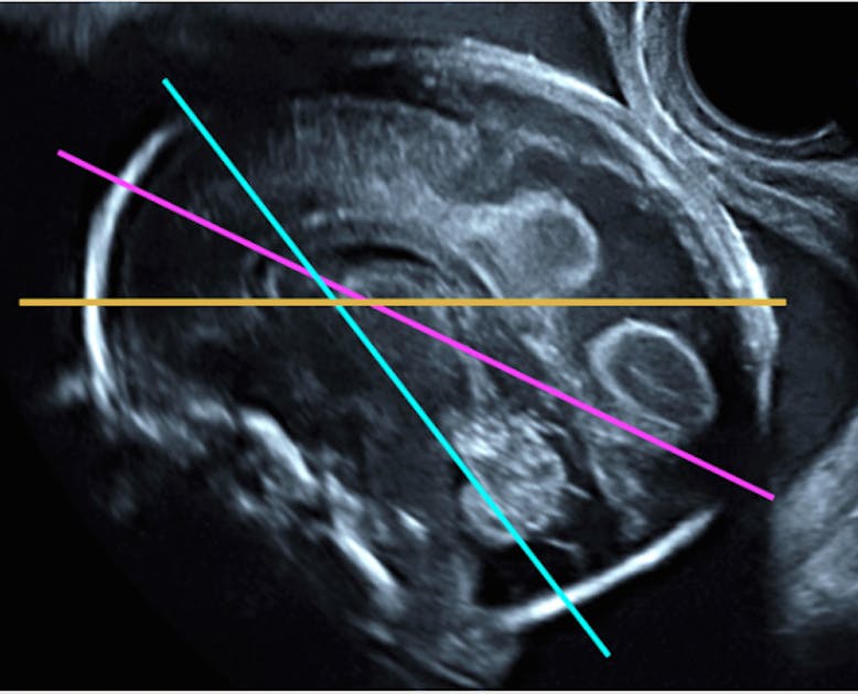 Fetal Brain Imaging: When to Study the Brain | Empowered Women's Health