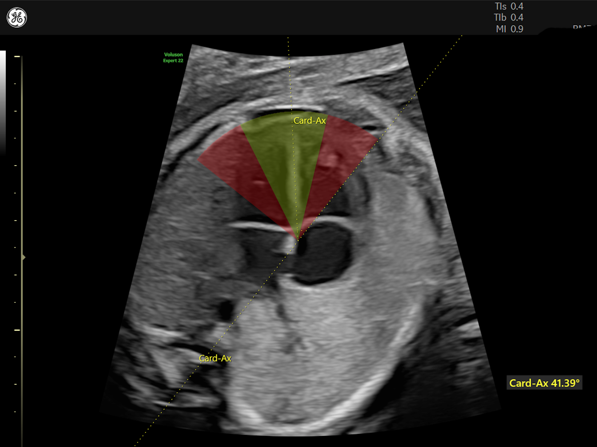 Changing Lives With Prenatal Ultrasound: Following Dr. Balu | Empowered ...