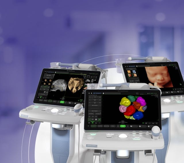 Visualizing PCOS String of Pearls | Ultrasound Diagnosis | Empowered ...