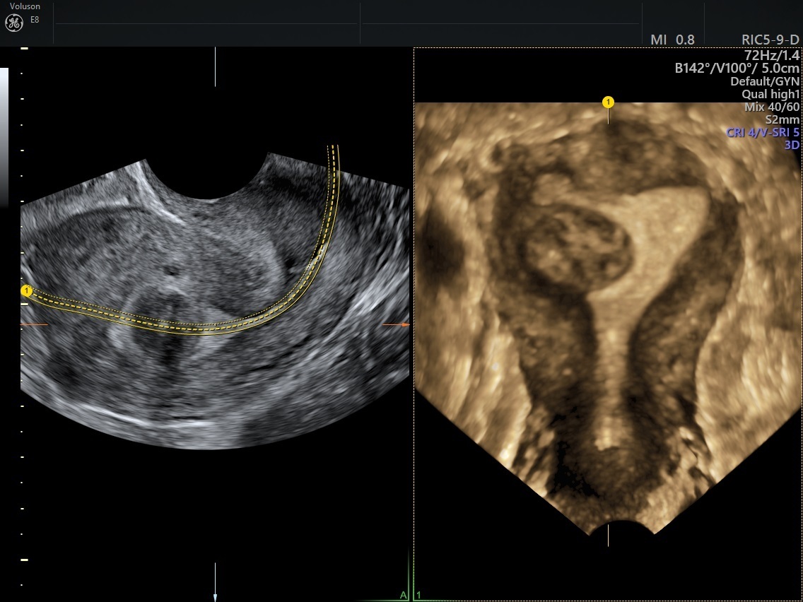 Pre-pregnancy Screening Promotes Overall Health | Empowered Women's Health