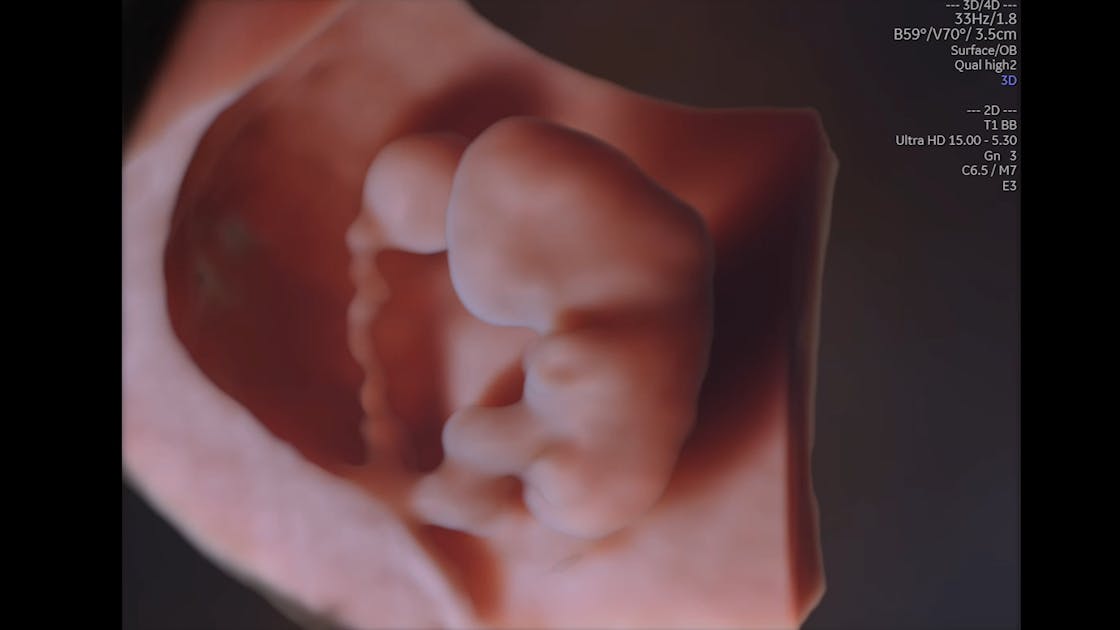 Fetal Viability: First-Trimester Anomaly Screening | Empowered Women's ...