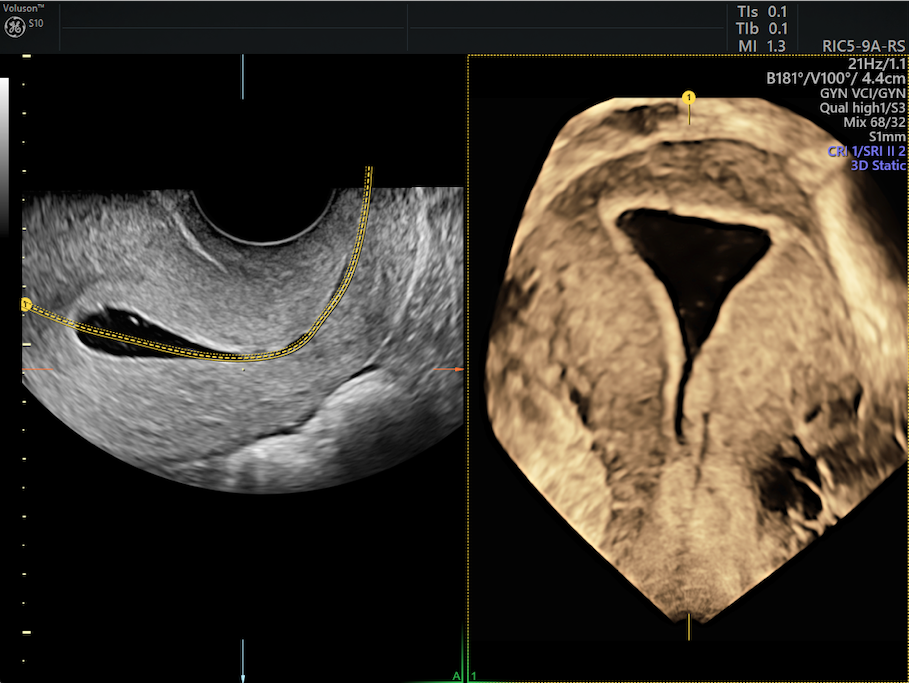 How to Explain the Female Infertility Workup to Patients | Empowered ...