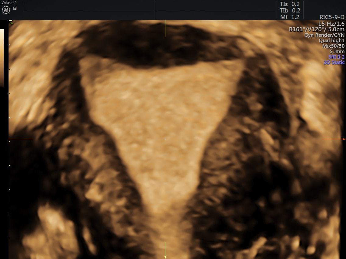 Improving the Patient Experience, One 3D Image at a Time | Empowered ...