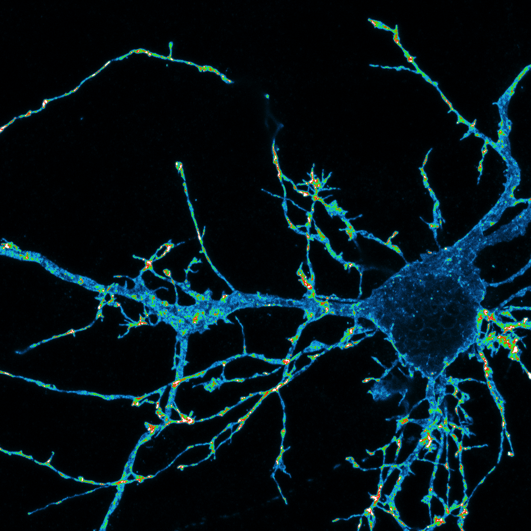 A trio of imaging techniques brings new insight into how neurons work