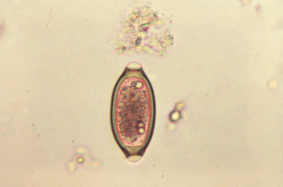 Eating more fiber feeds whipworm parasites in our guts